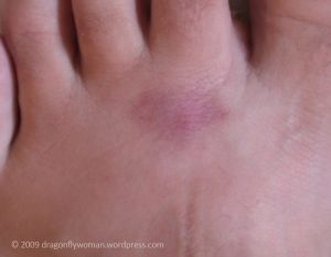 Do Dragonflies Bite or Sting? Nature's Helicopter Secrets! - Animal Hype